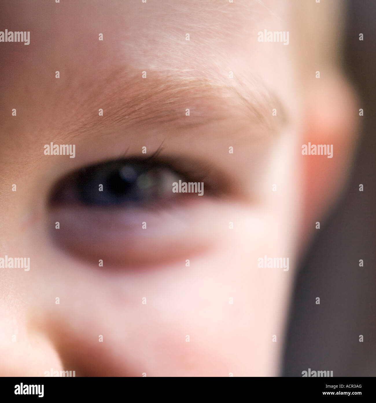 only eyebrow in focus Stock Photo - Alamy