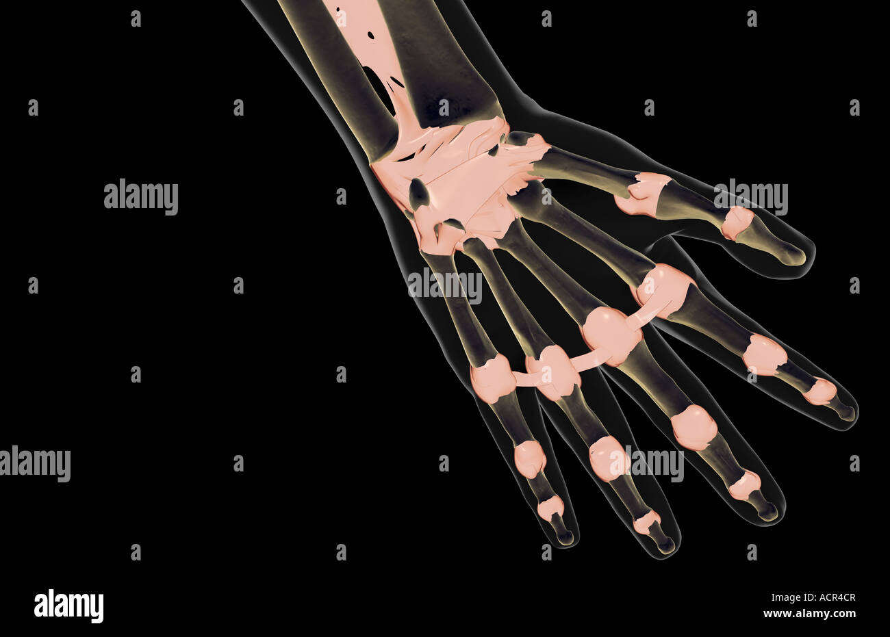 The ligaments of the hand Stock Photo - Alamy