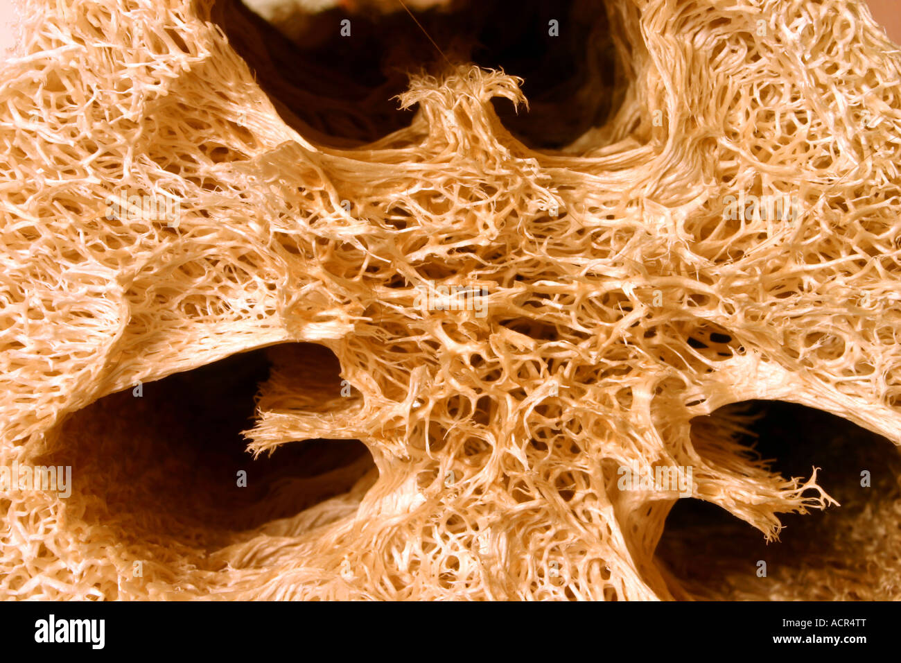 Sponge Skeleton Cross Section