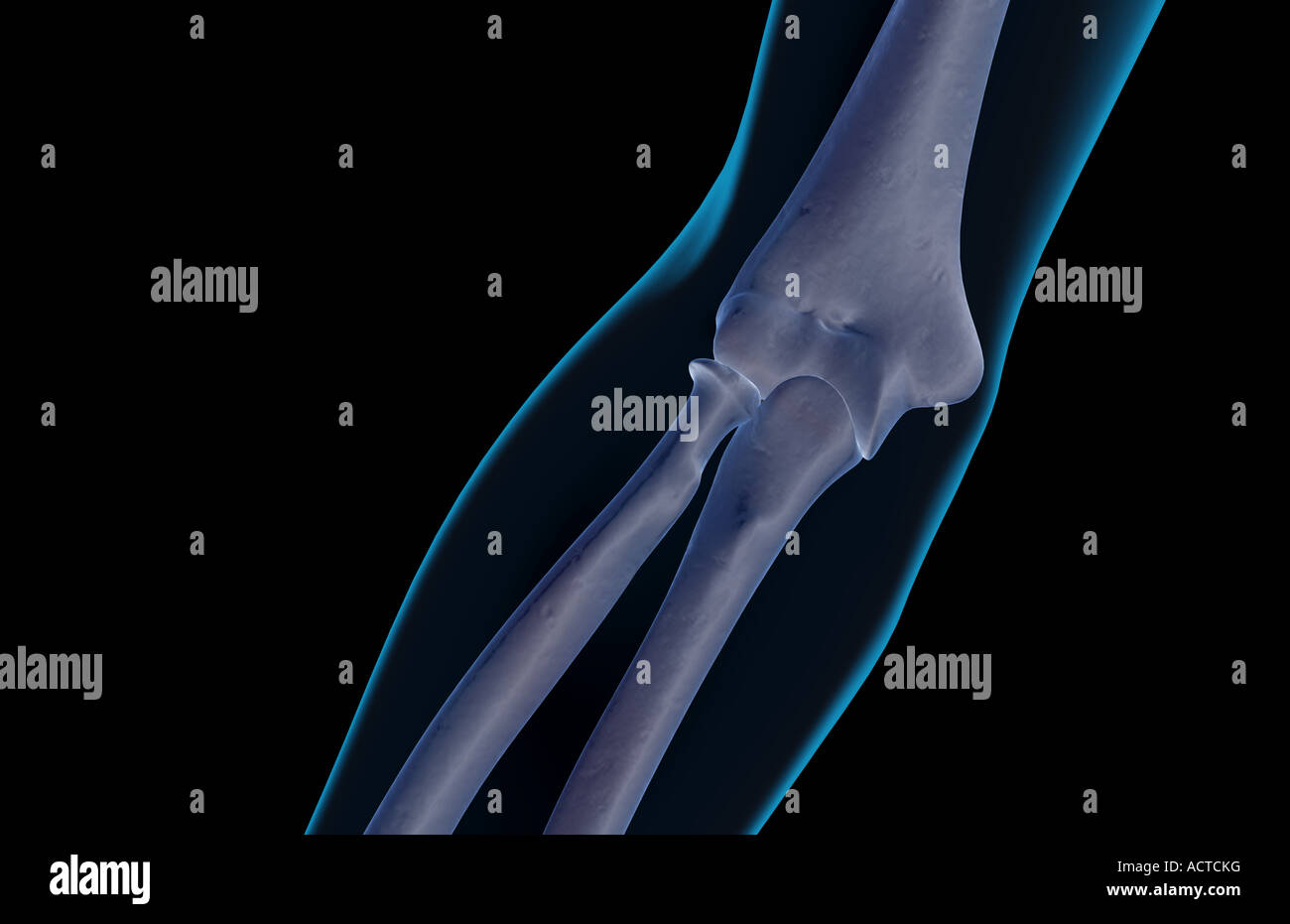 The bones of the elbow Stock Photo - Alamy