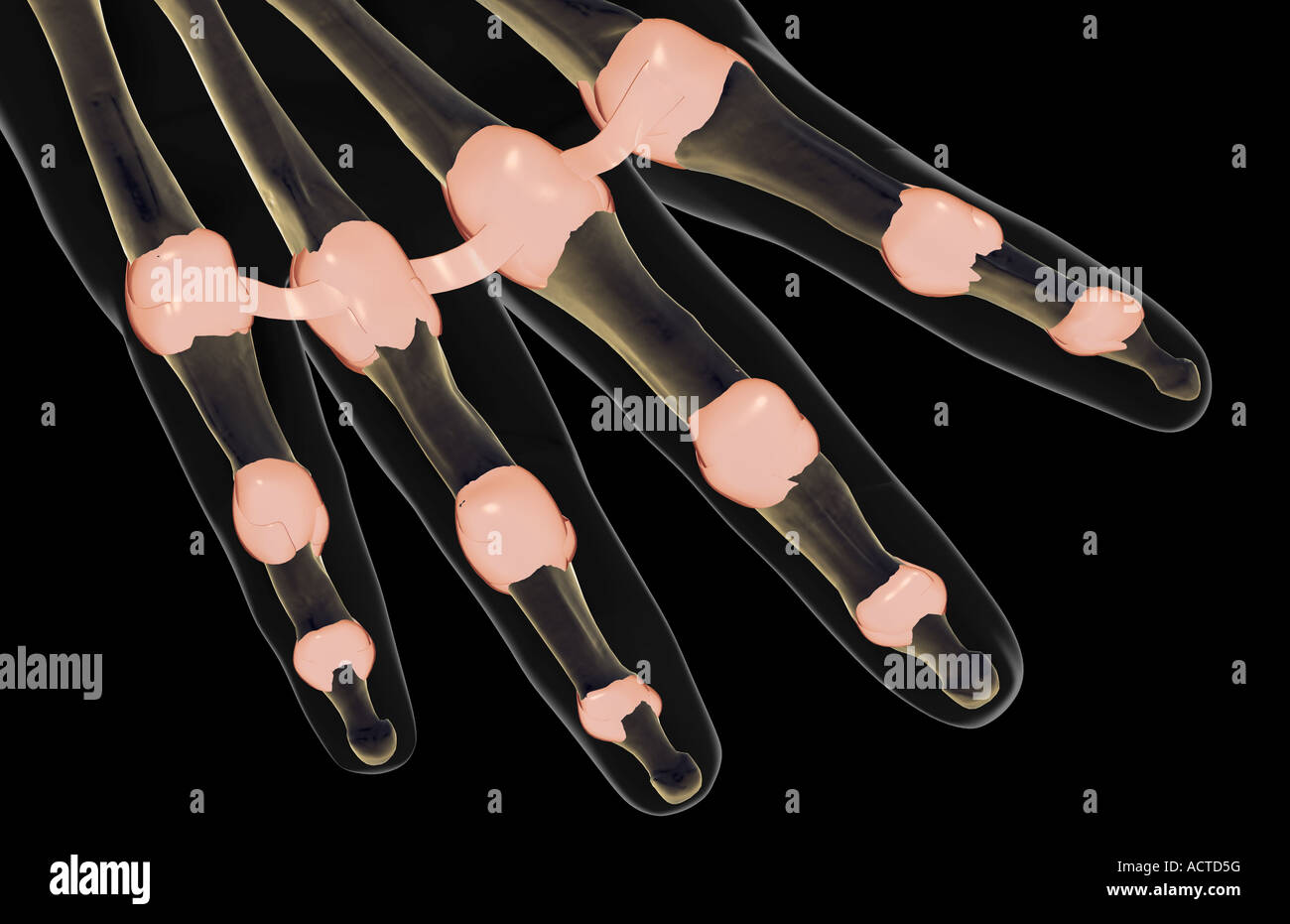 Finger ligaments hi-res stock photography and images - Alamy