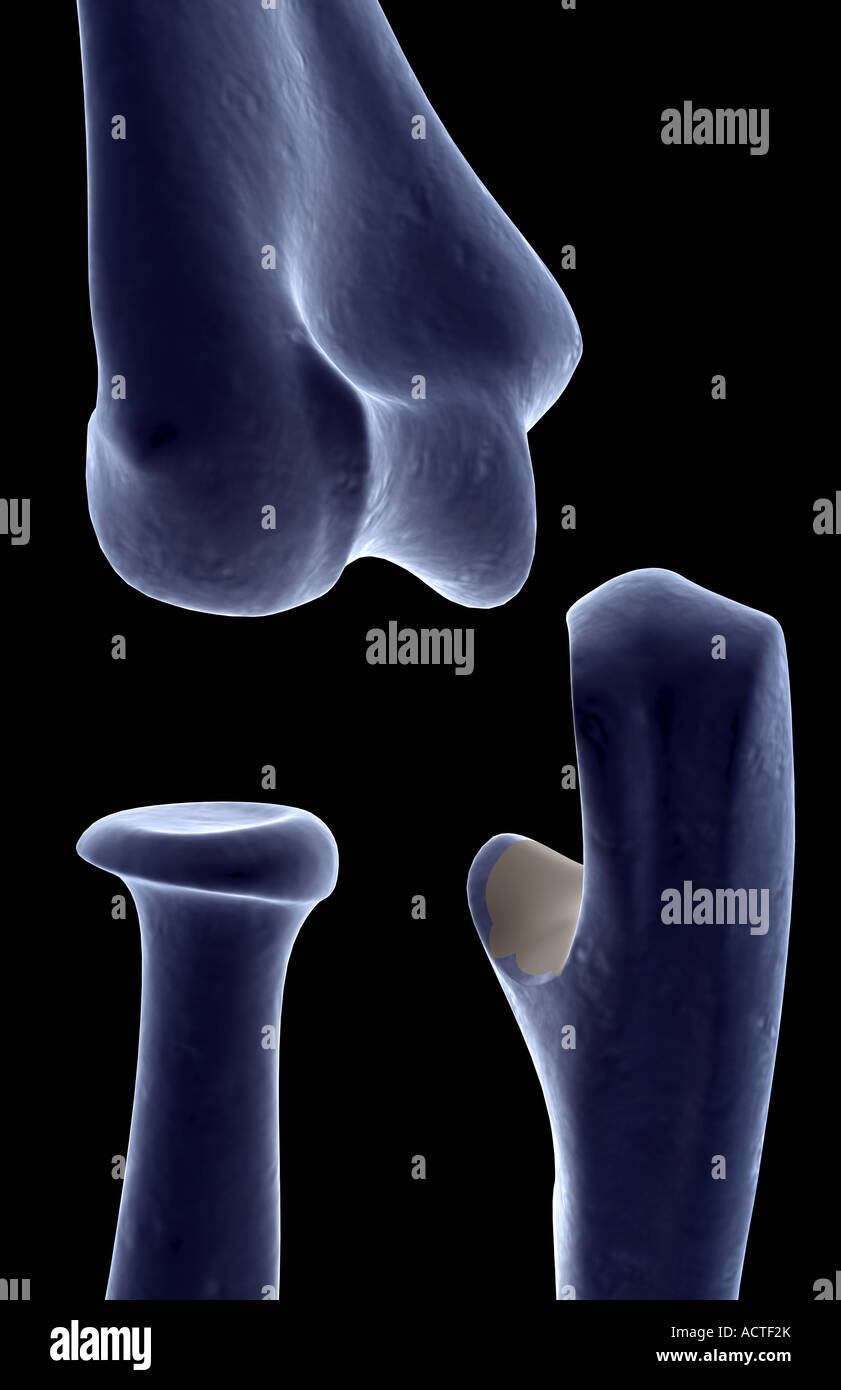 Olecranon Fossa High Resolution Stock Photography and Images - Alamy