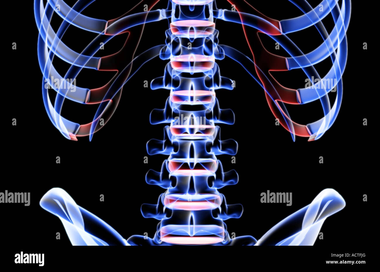 X Ray Lower Back High Resolution Stock Photography and Images - Alamy