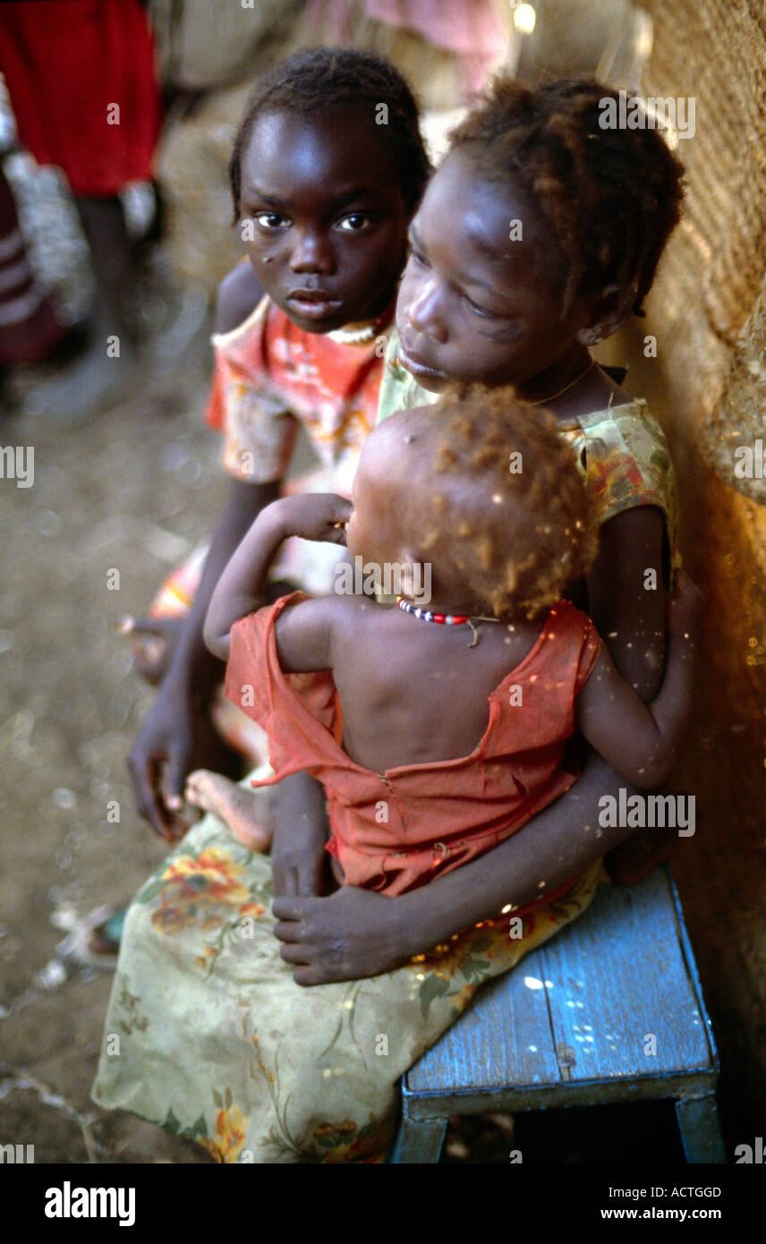 Sinnar Sudan Children with Kwashikor Waiting for Medical Treatment Hair ...