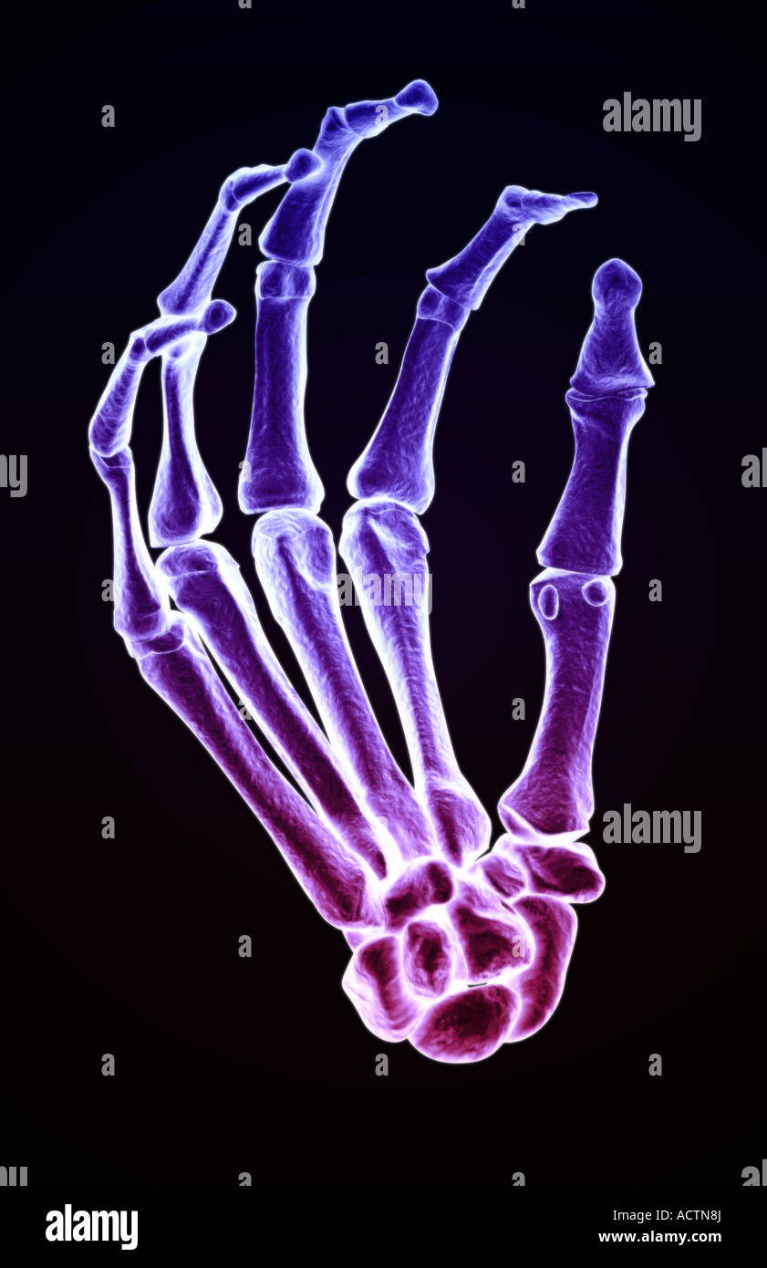 Bones of the hand Stock Photo - Alamy