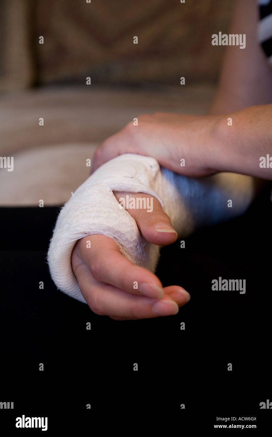 Colles fracture hi-res stock photography and images - Alamy