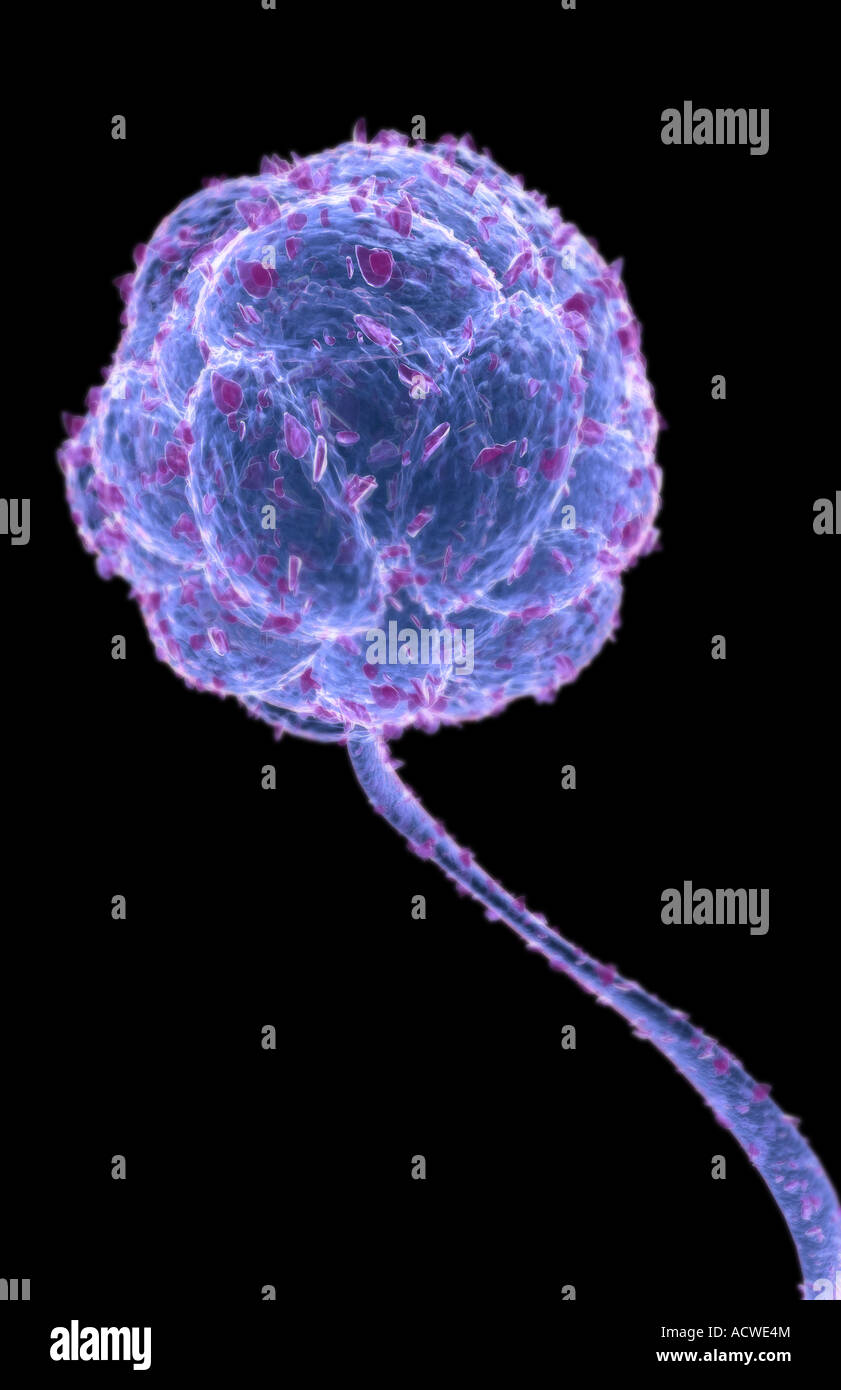 Stachybotrys chartarum hi-res stock photography and images - Alamy