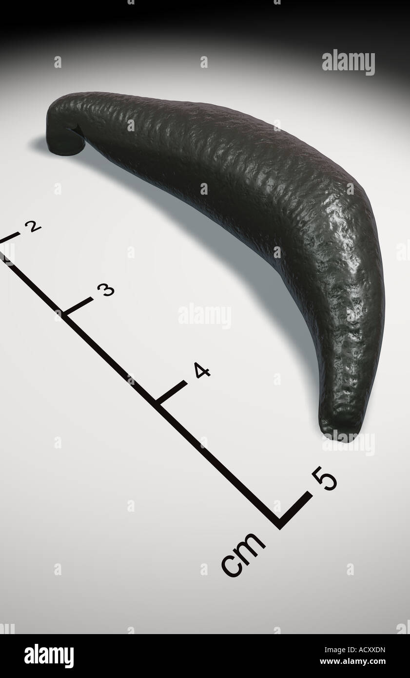 Bloodletting with leeches hi-res stock photography and images - Alamy