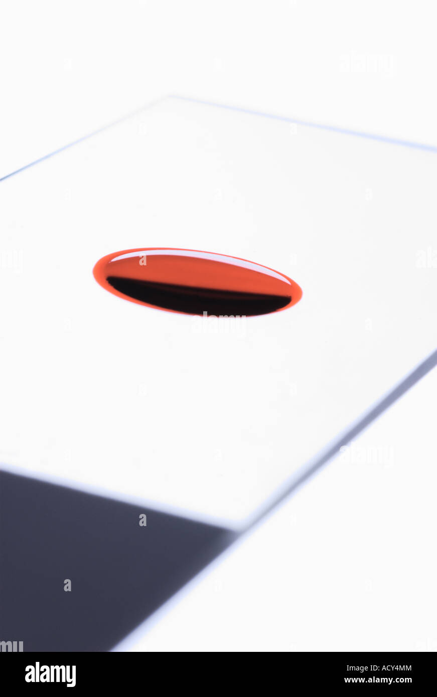 microscope slide blood sample isolated on a white background with space ...