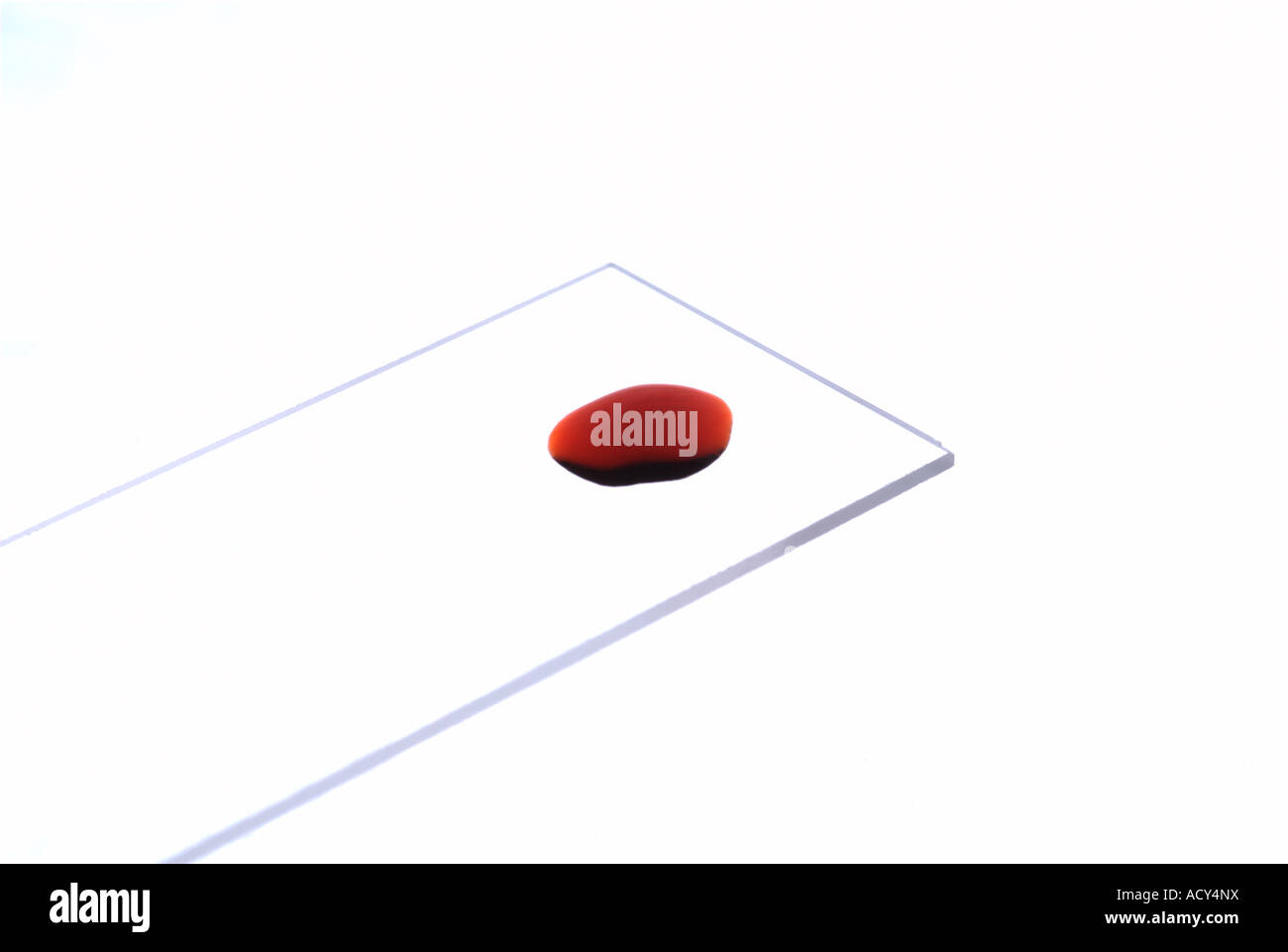microscope slide with blood sample isolated on a white background with ...