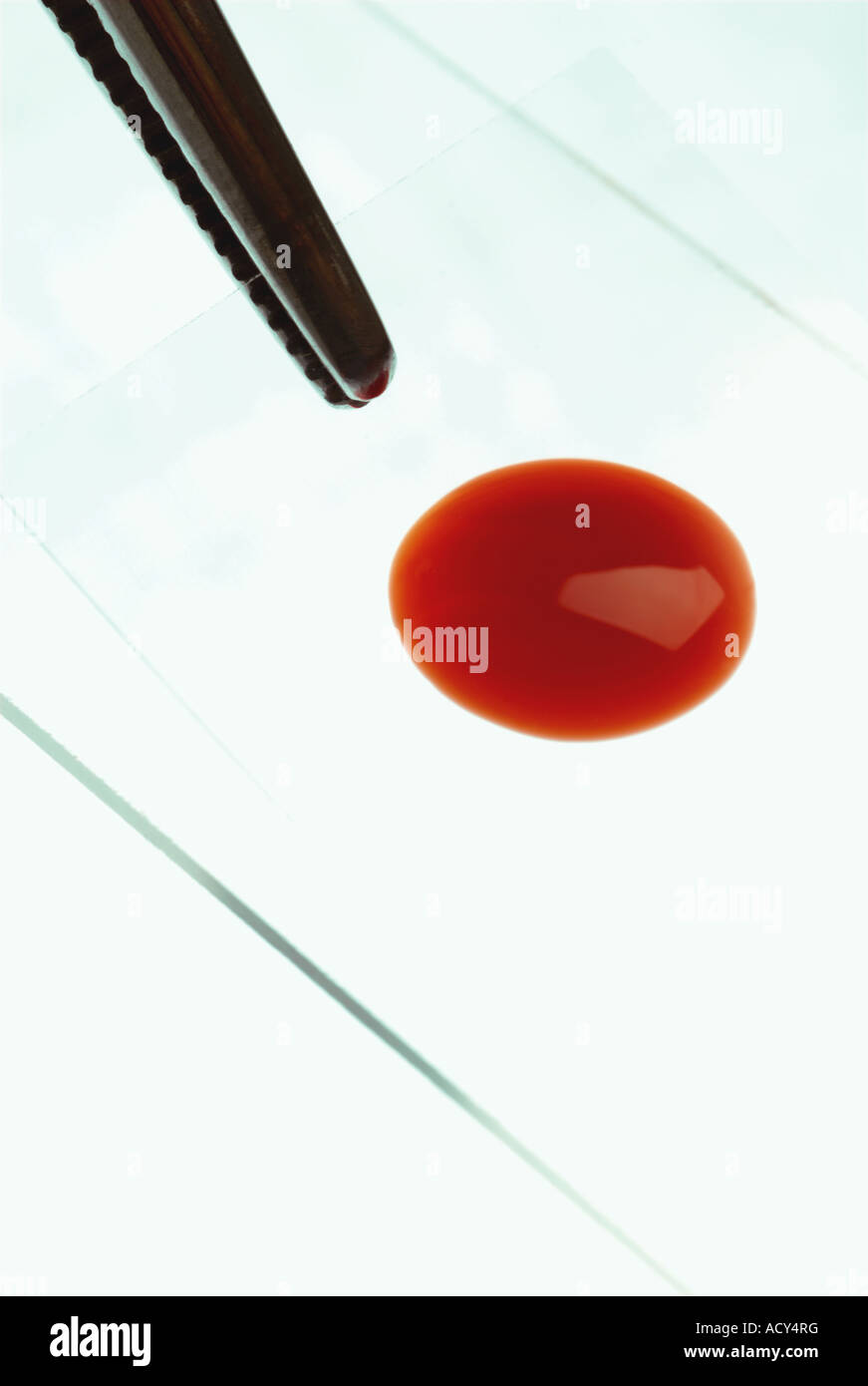 Microscope slide, forceps, cover slip with blood sample isolated on ...