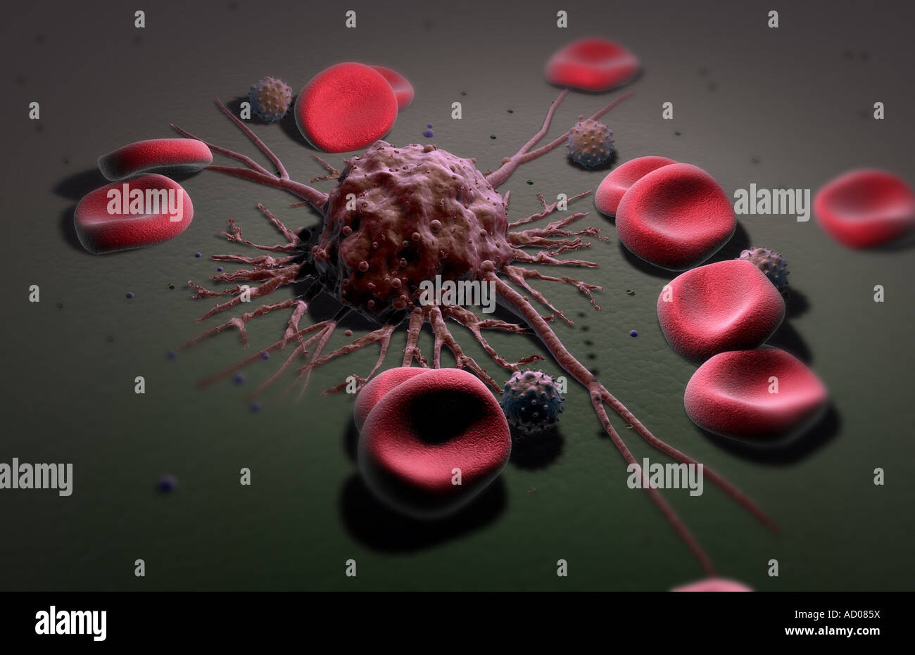 Metastasis hi-res stock photography and images - Alamy