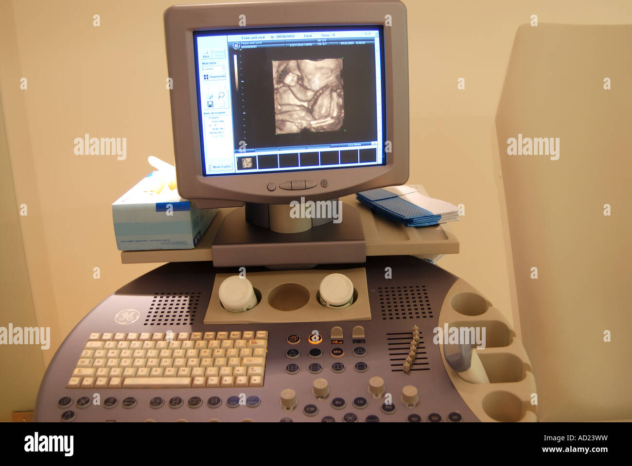 fetus cord echography pregnancy screen scan Stock Photo - Alamy