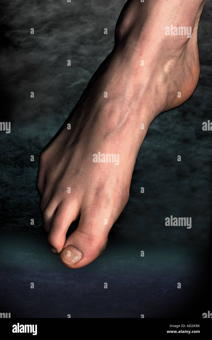 Grotesque body hi-res stock photography and images - Alamy