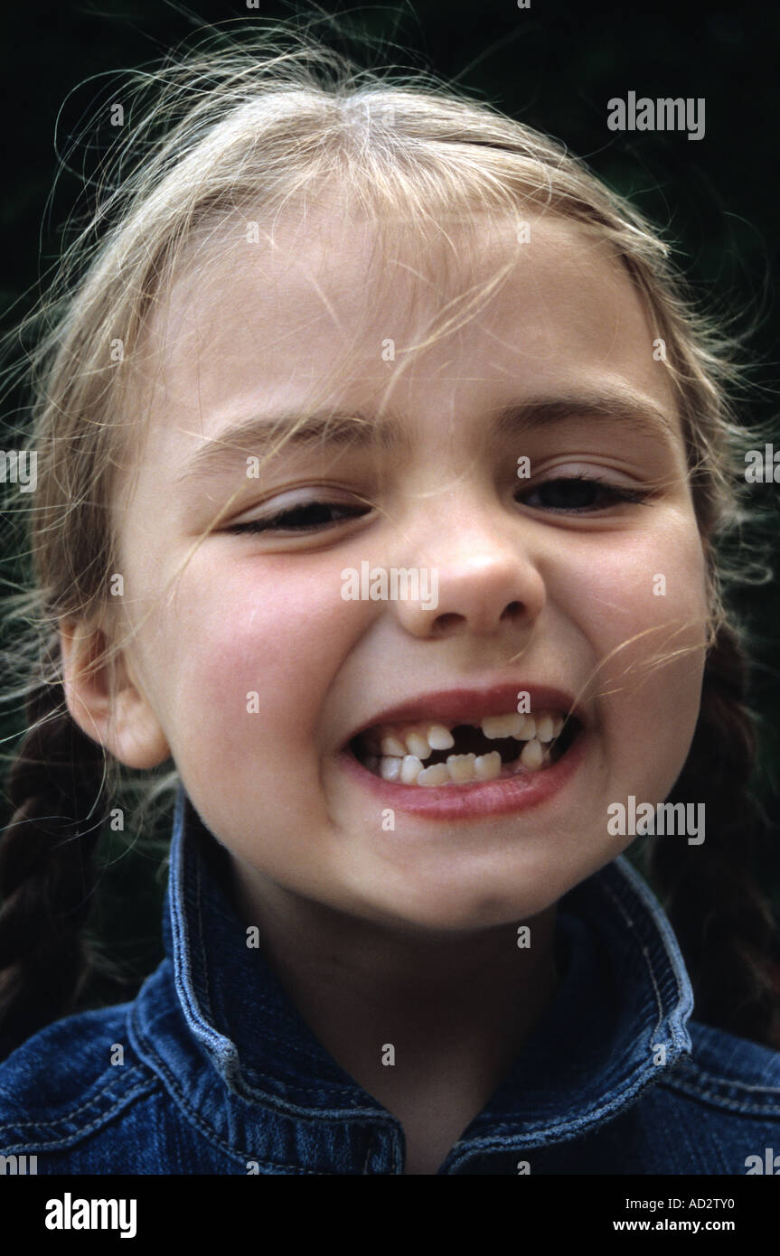 Young Girl Showing Developing Teeth Stock Photo - Alamy