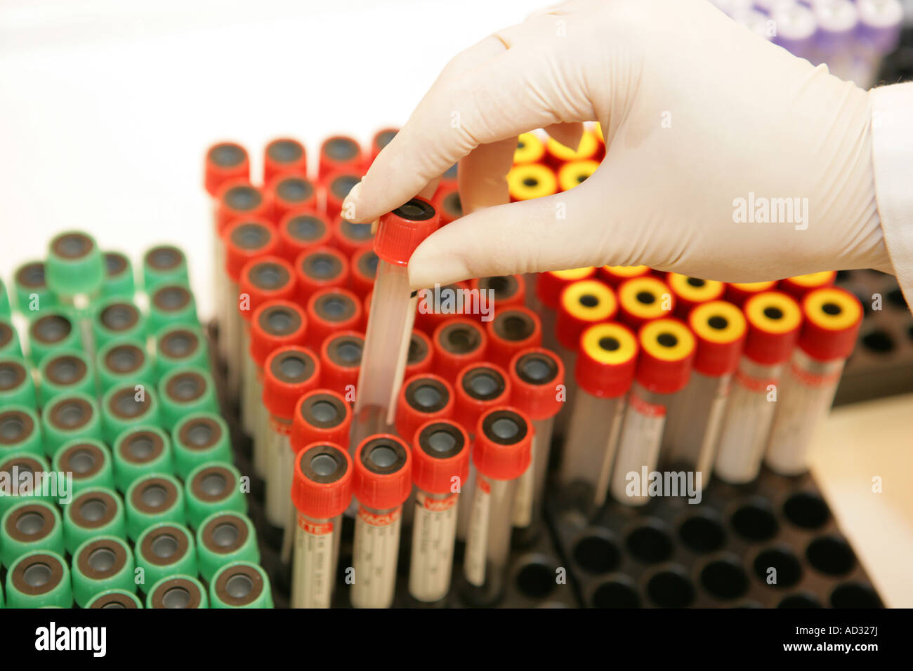 Blood Test Sample Tubes Stock Photo - Alamy