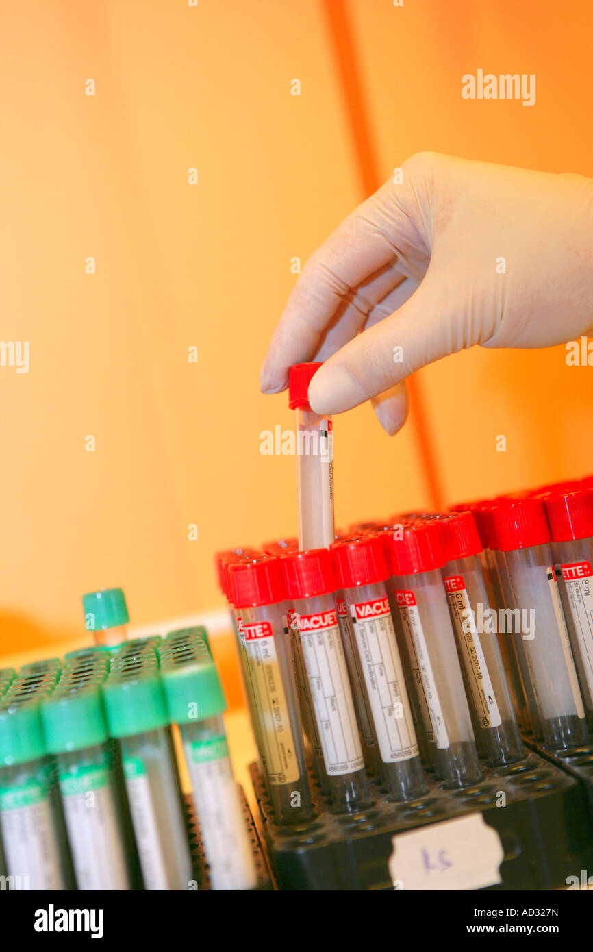 Blood Test Sample Tubes Stock Photo - Alamy