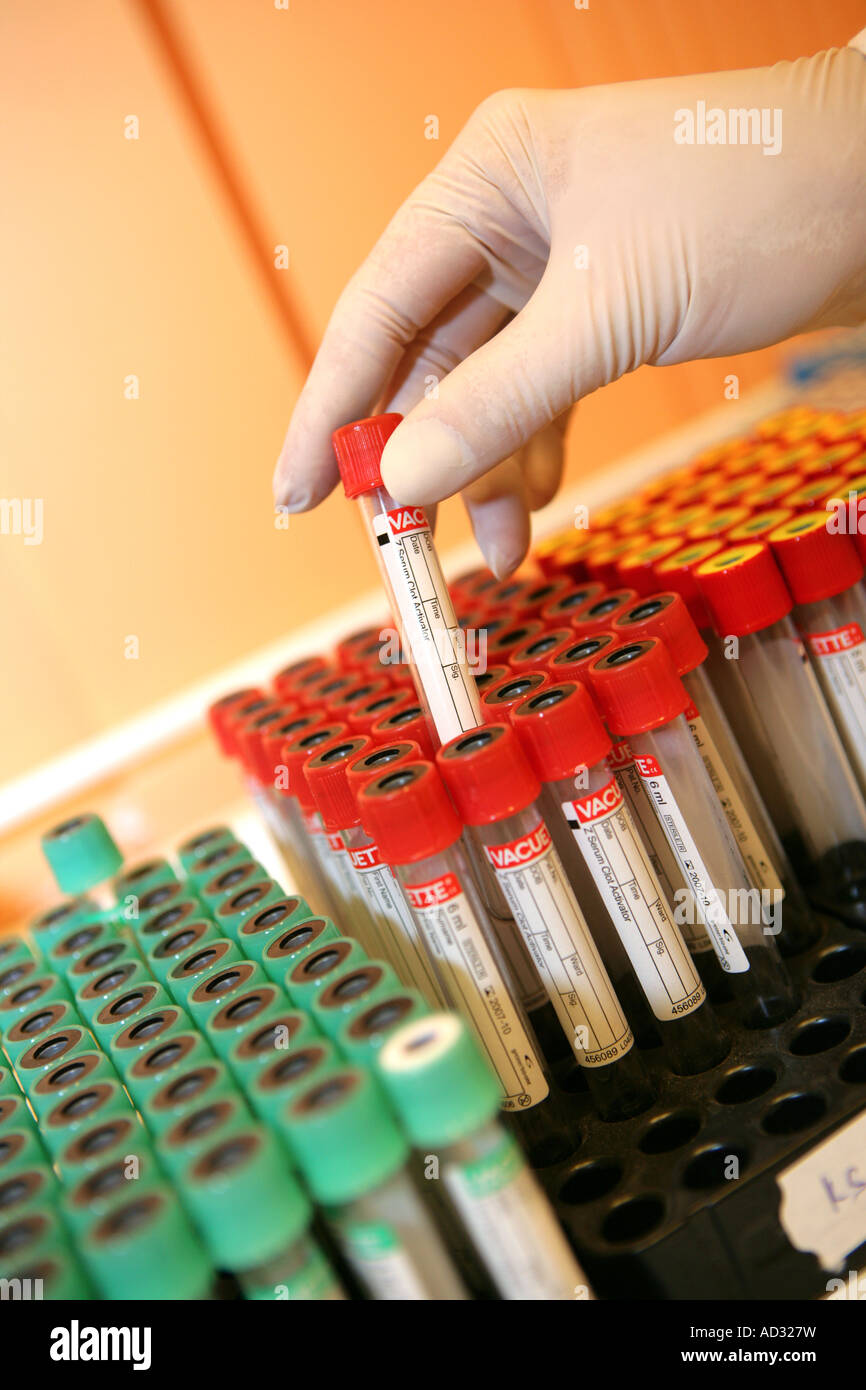 Blood Test Sample Tubes Stock Photo - Alamy