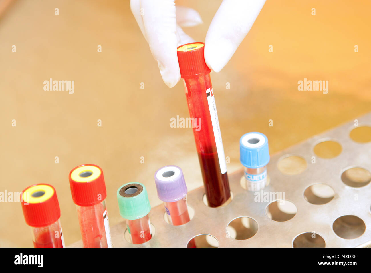 Blood Test Sample Tubes Stock Photo - Alamy