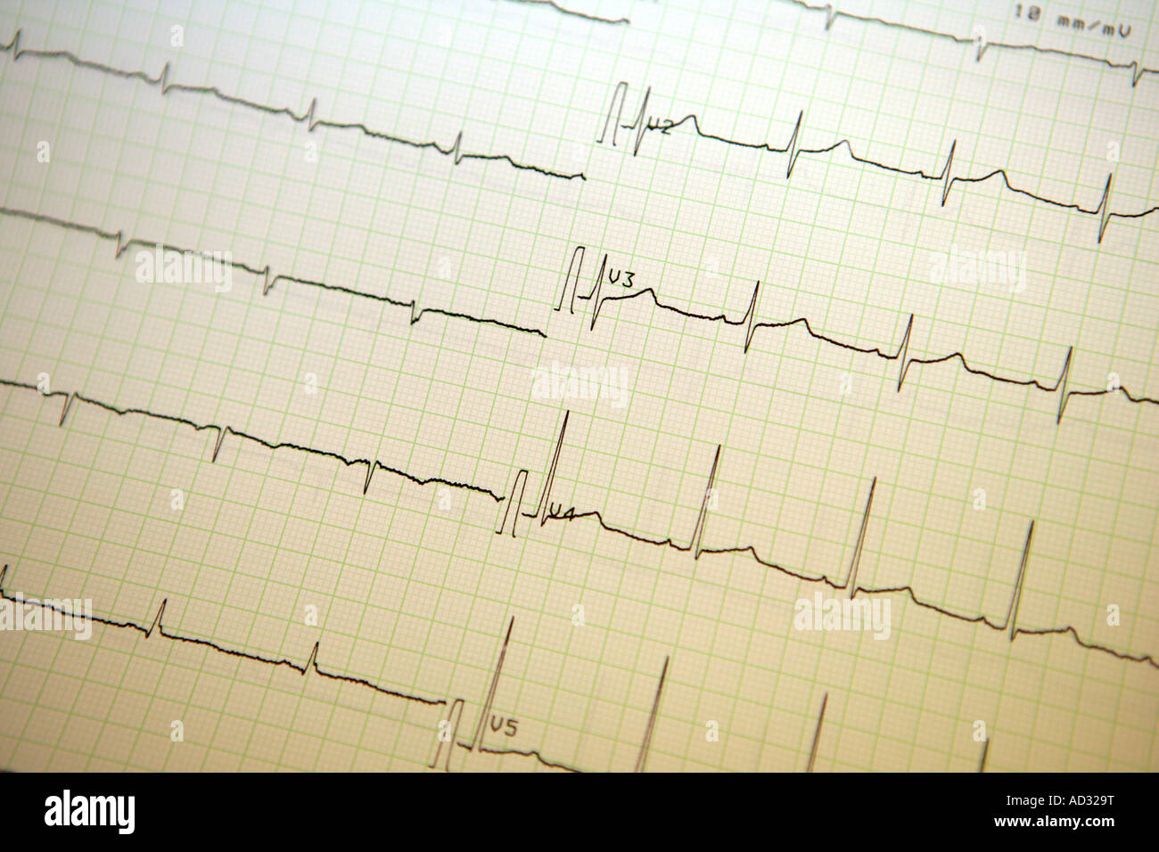 Ecg printout hi-res stock photography and images - Alamy