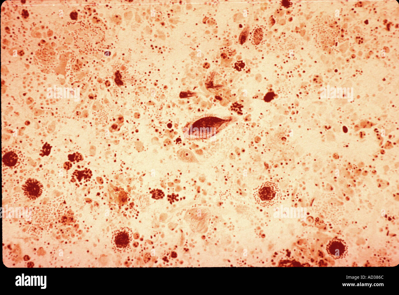 Science Microscopic Protozoan parasite Stock Photo - Alamy