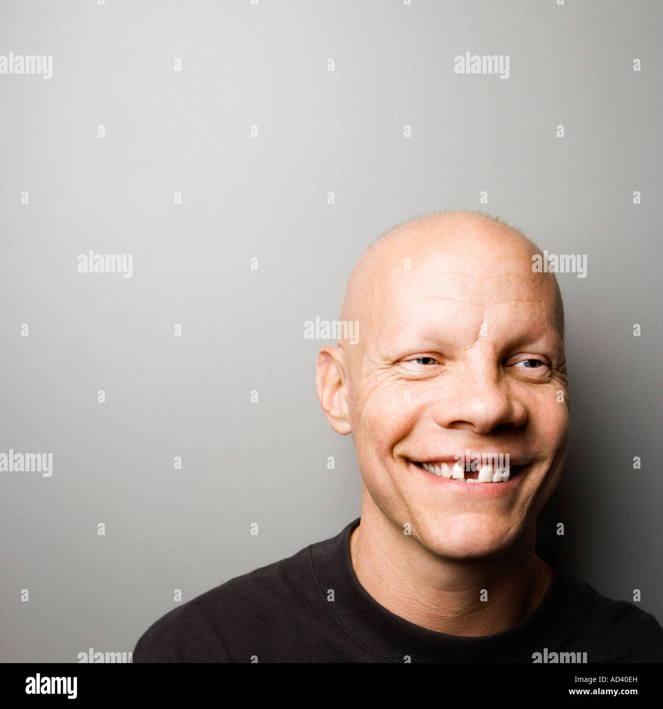 Tooth missing man hi-res stock photography and images - Alamy