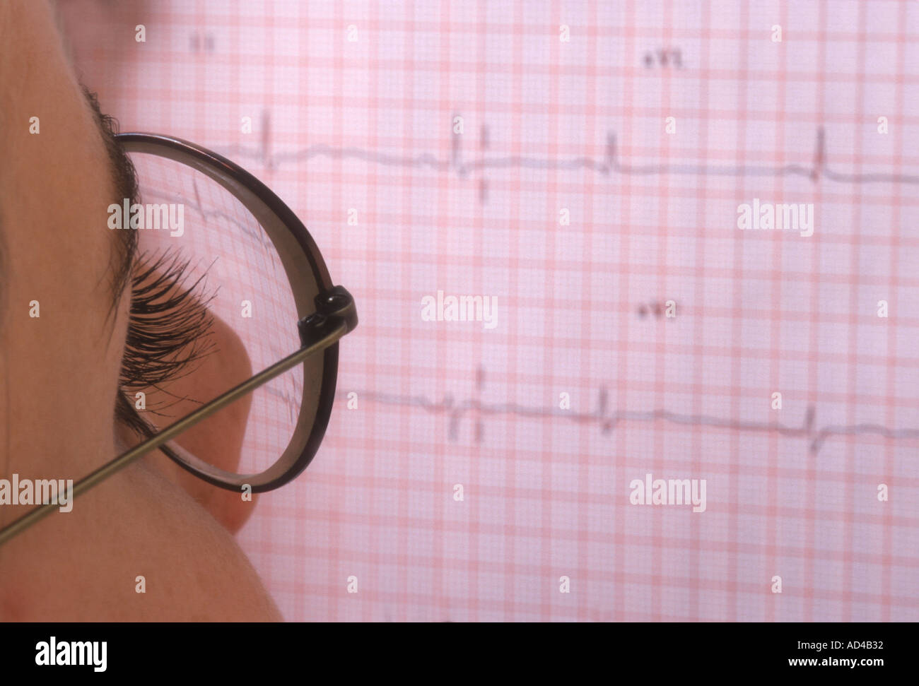 Ekg woman hi-res stock photography and images - Alamy