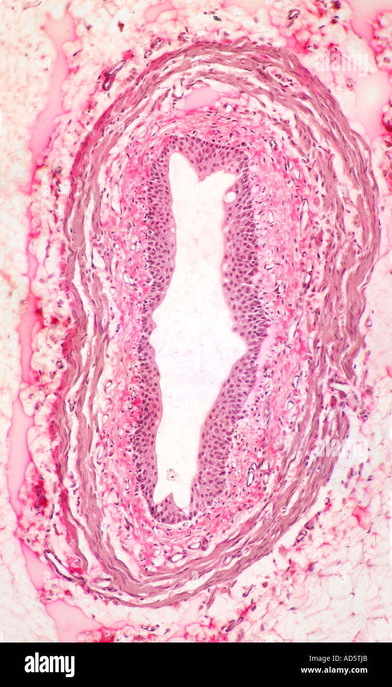 Urethra hi-res stock photography and images - Alamy