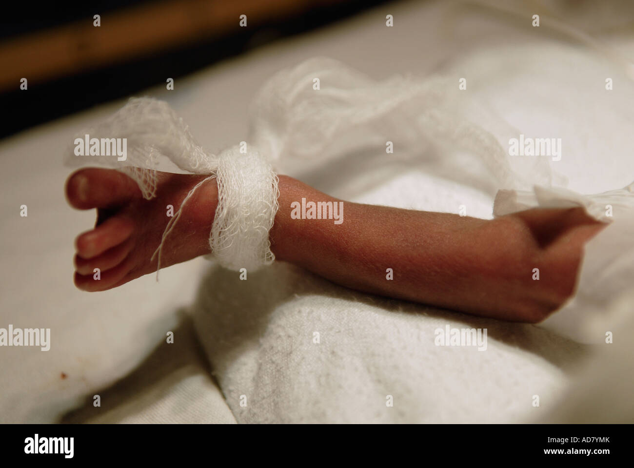 Pulse Oximeter attached to premature infant Stock Photo - Alamy