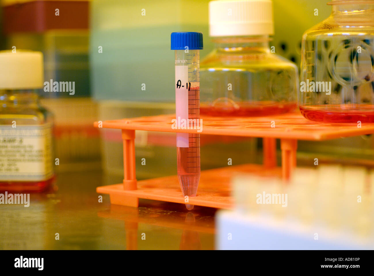 Amniotic Fluid Sample