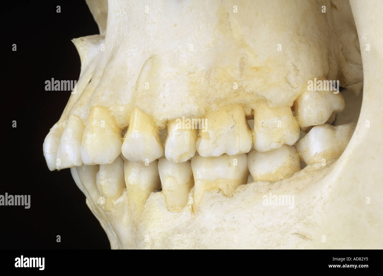 Side view of human jaw Stock Photo - Alamy