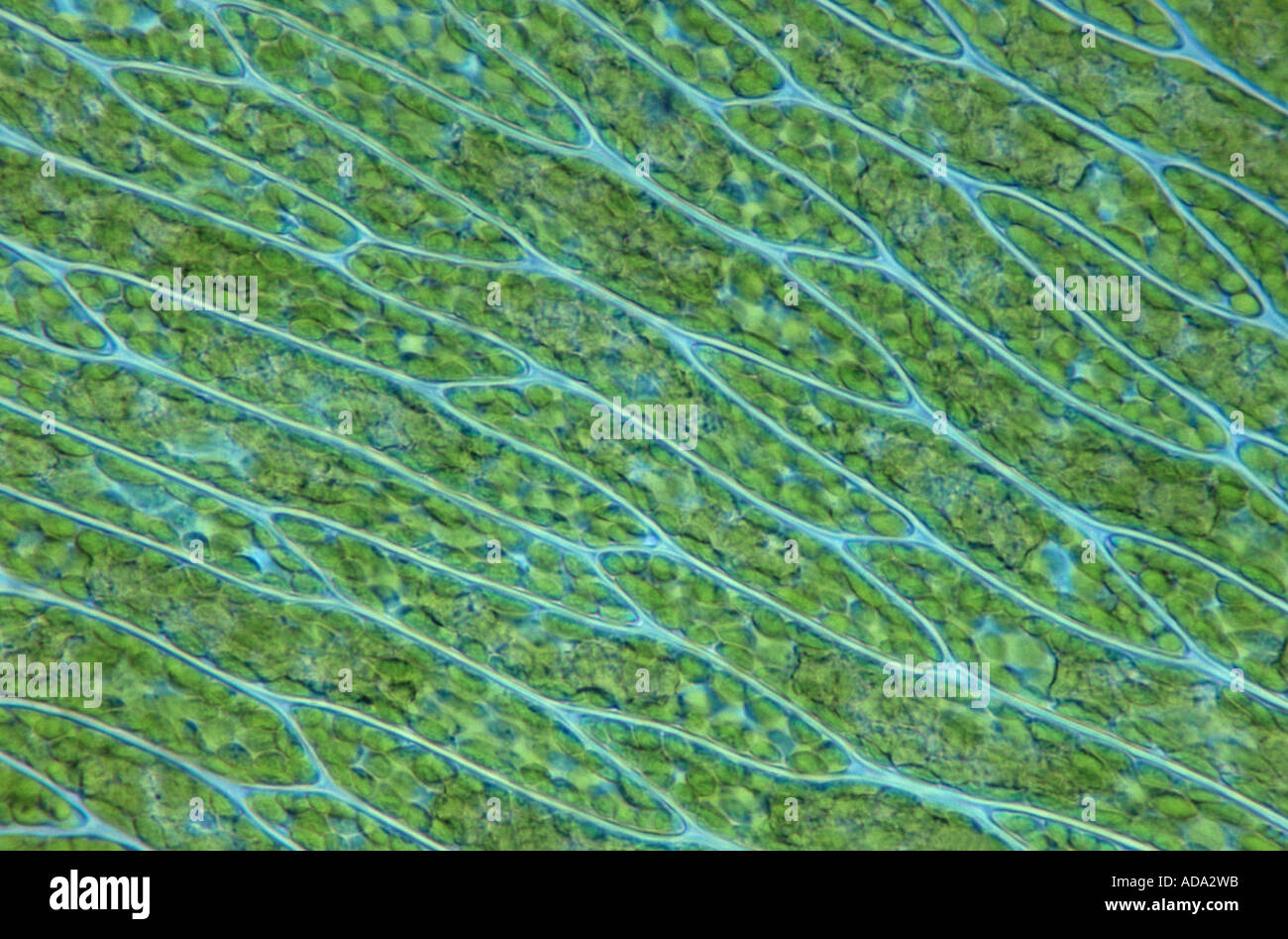 Moss Plant Under Microscope