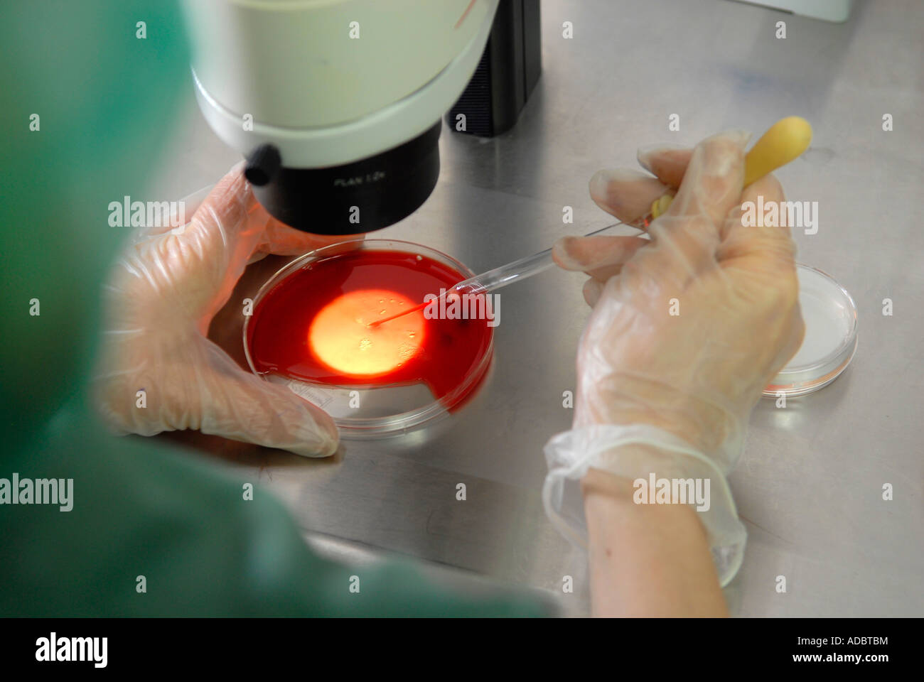 Embryologist placing embryo on a culture dish during Vitrification ...