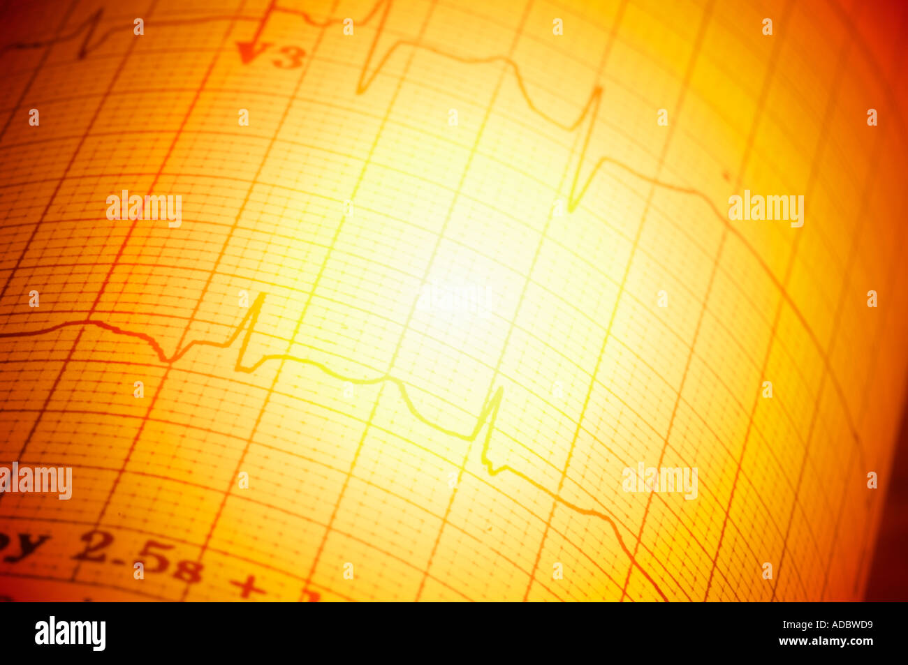 EKG Electrocardiogram closeup Stock Photo - Alamy