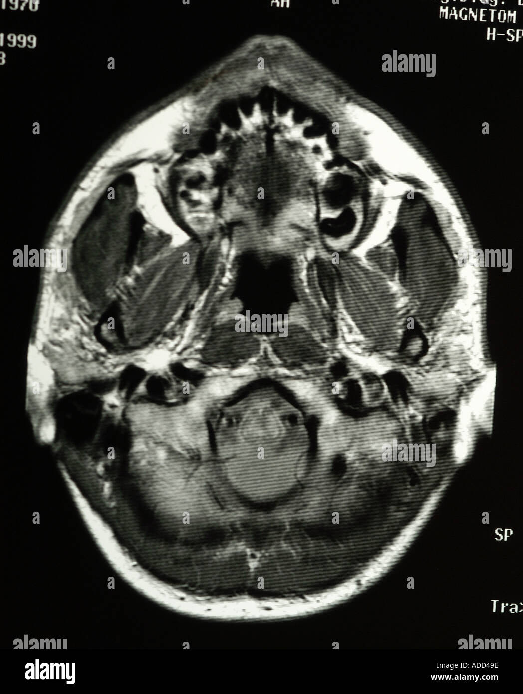 scan of human brain Stock Photo - Alamy