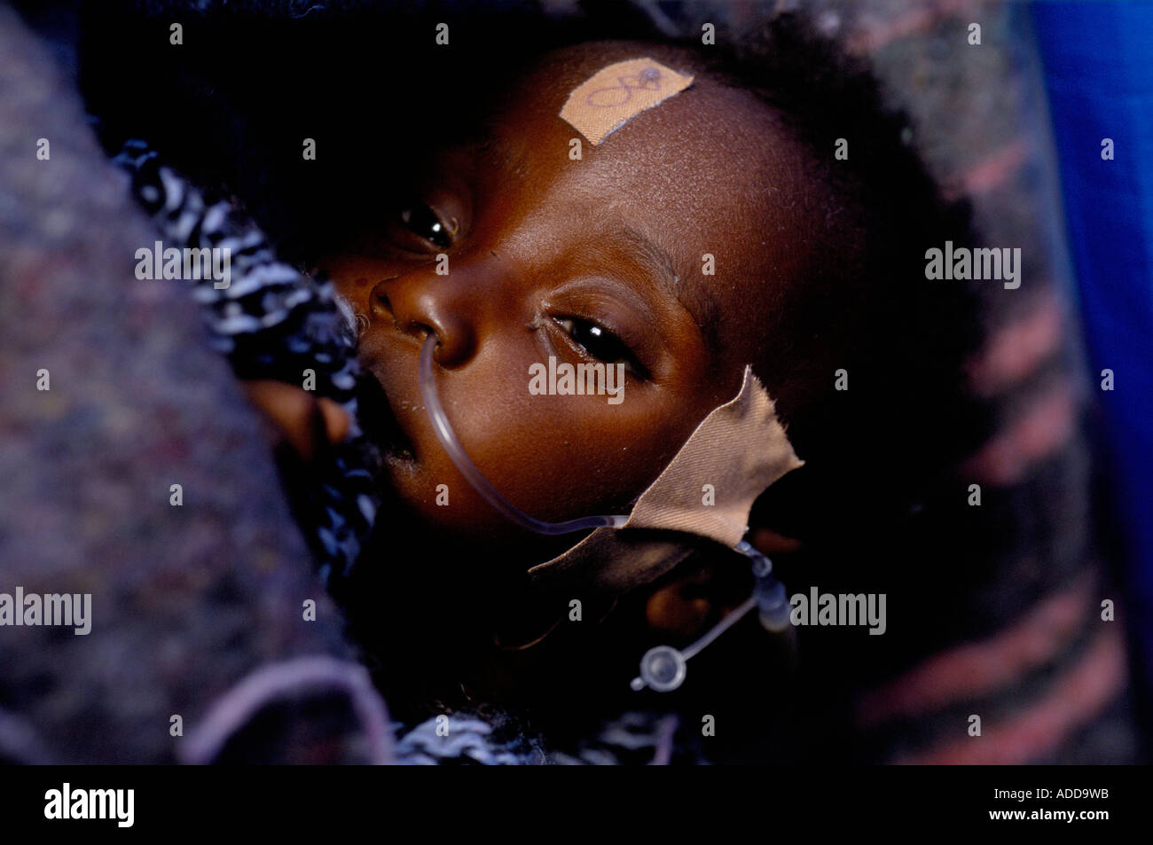 Baby on a rehydration drip under blanket Stock Photo - Alamy