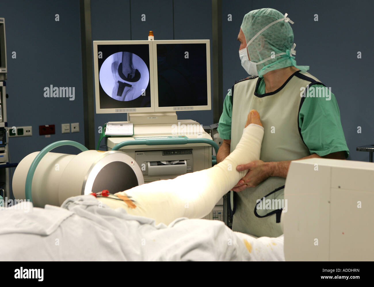 DEU, Germany : Knee surgery, artificial knee joint Stock Photo - Alamy