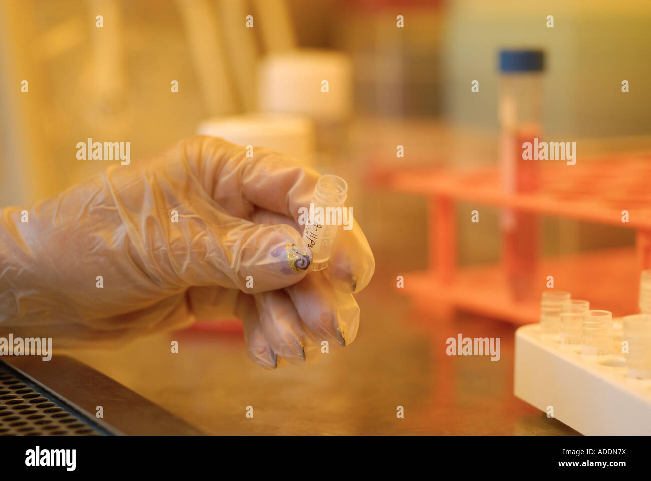 A lab technician holds a test tube at the IVF In vitro fertilization ...