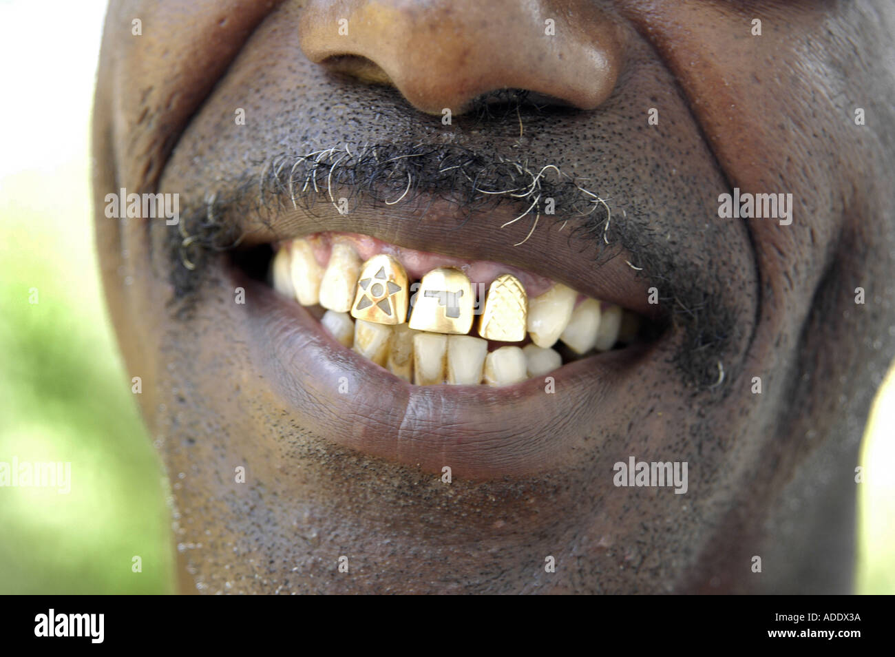 Golden_teeth hi-res stock photography and images - Alamy