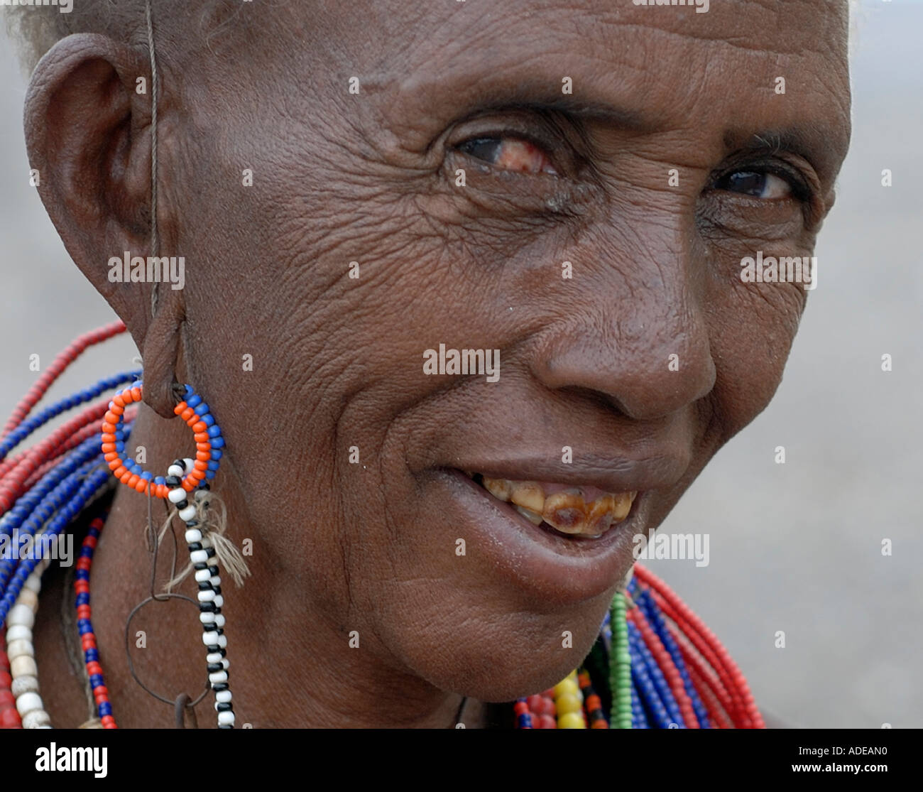 Elderly El Molo woman stained teeth are the result of drinking water ...