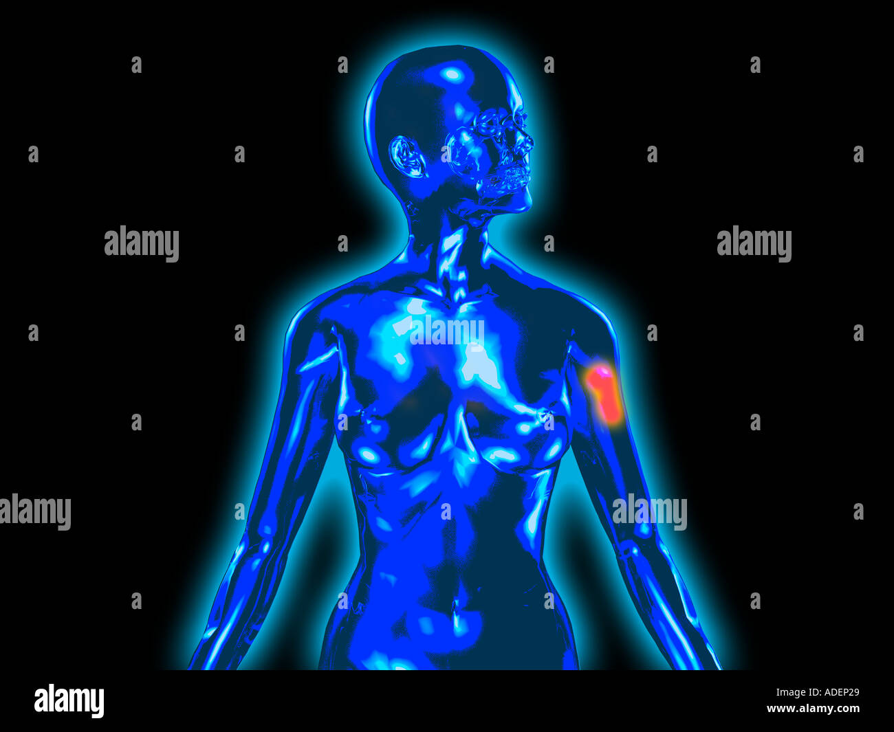 Upper arm xray hi-res stock photography and images - Alamy