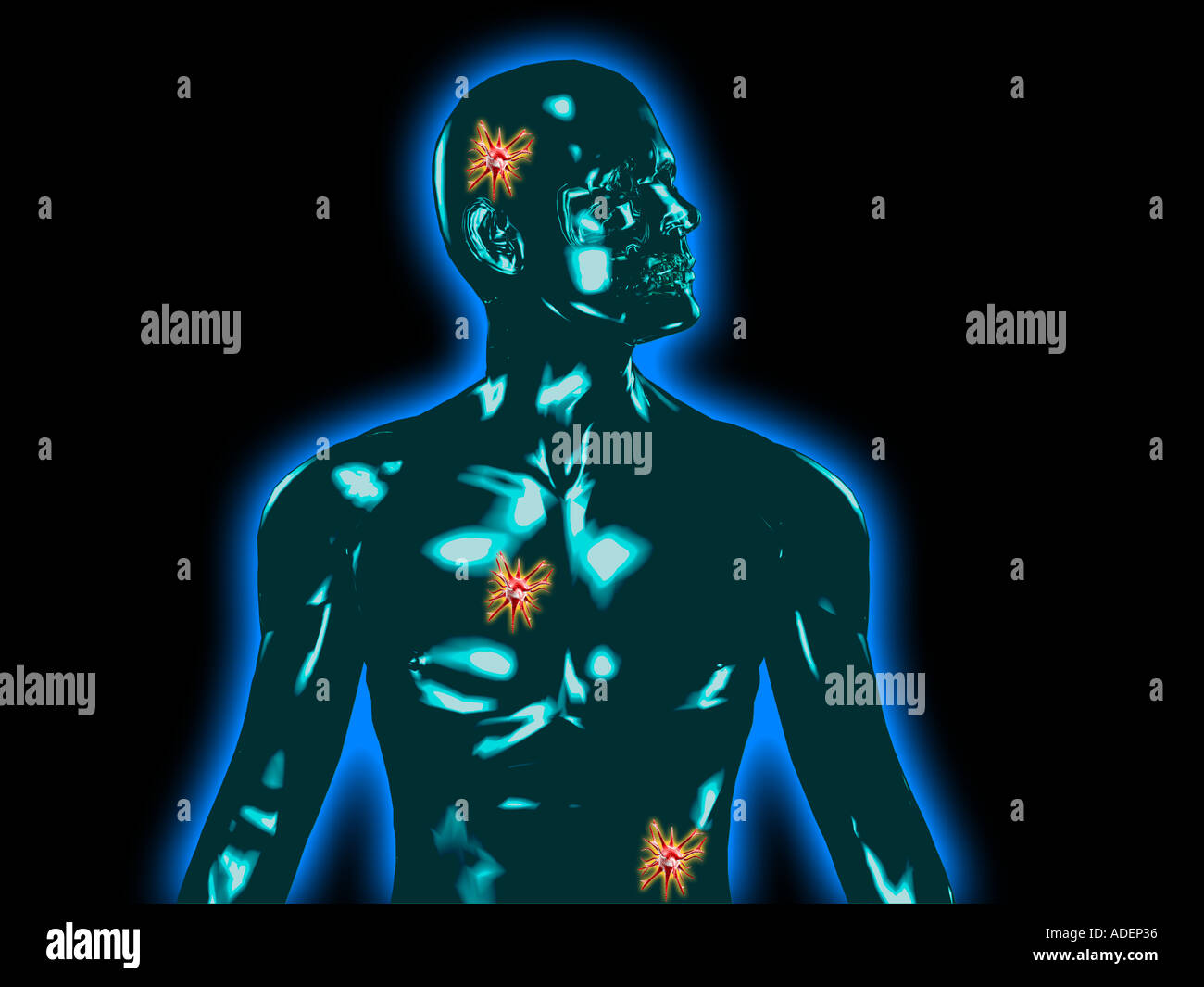 cancer or tumors on a male body concept Stock Photo - Alamy