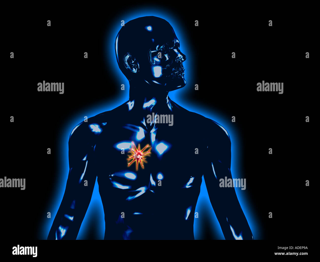 lung cancer in a male body Stock Photo - Alamy