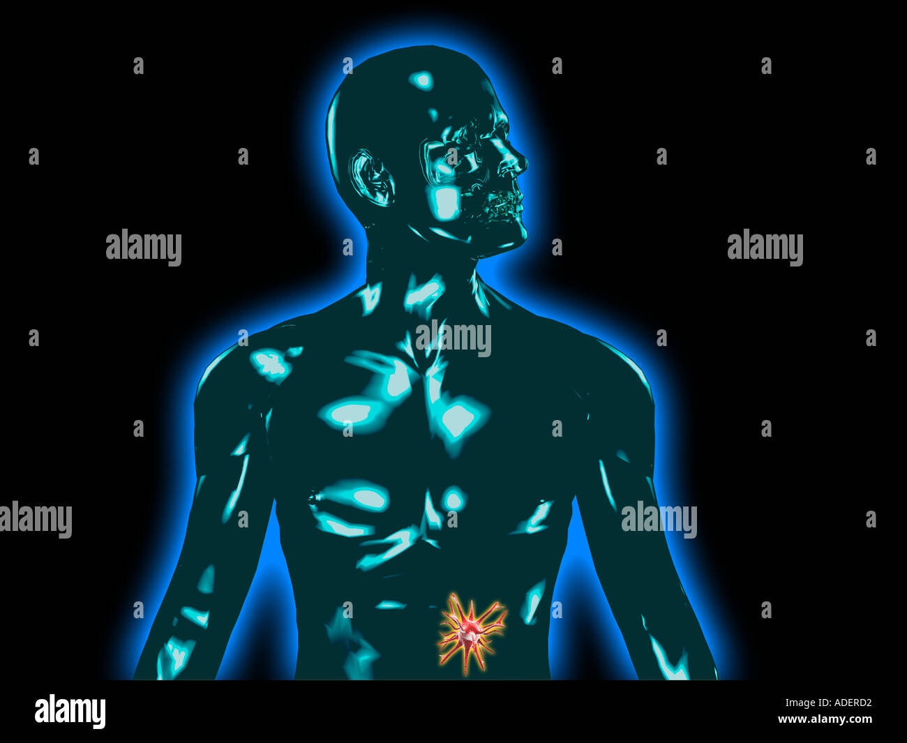 stomach cancer or tumor male body Stock Photo - Alamy