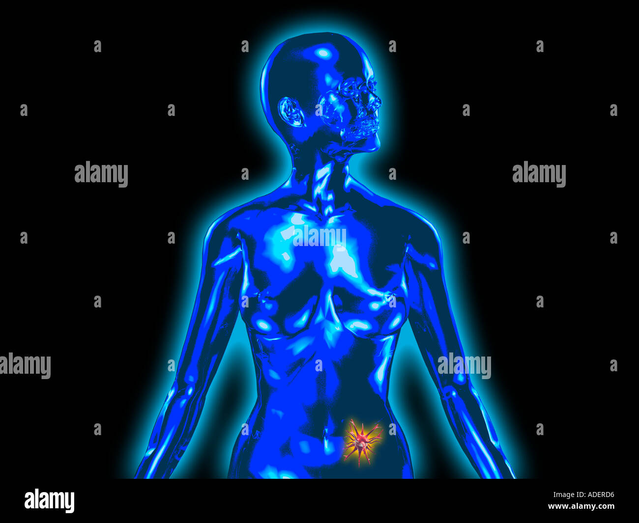 stomach cancer or tumor female body Stock Photo - Alamy