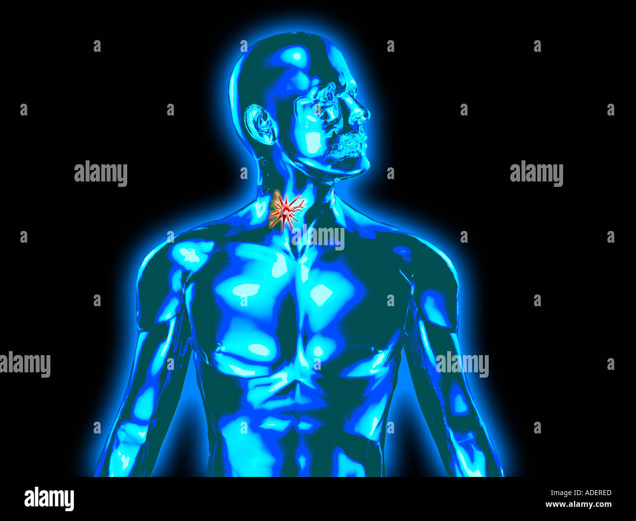 throat cancer male body Stock Photo - Alamy