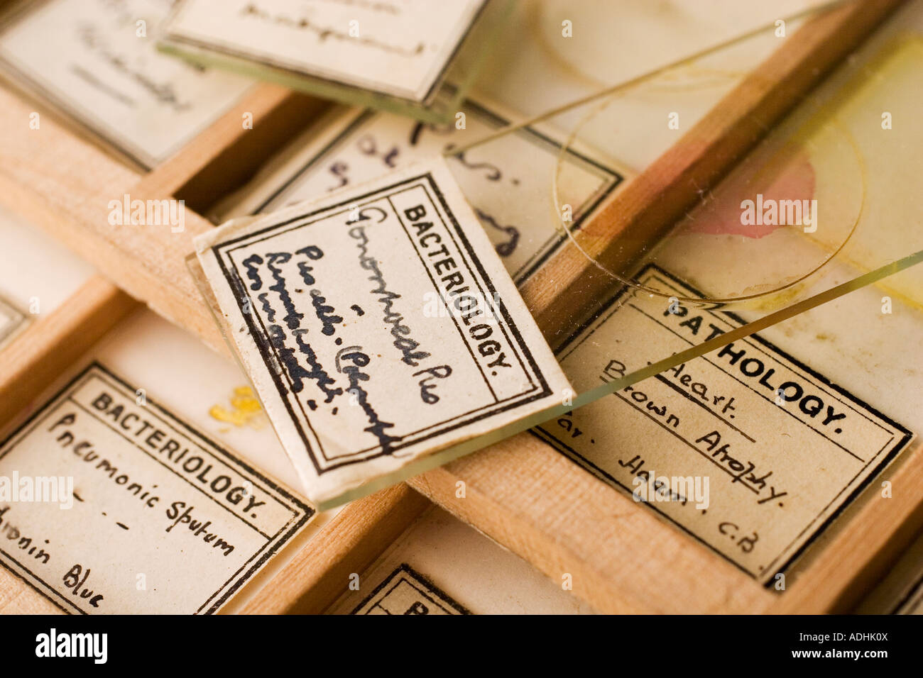 antique pathology slides in a wooden presentation tray Stock Photo - Alamy