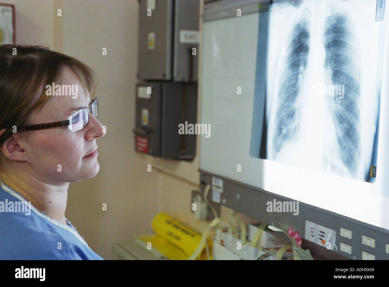 The X ray department is used for assessing damage and for treatment ...