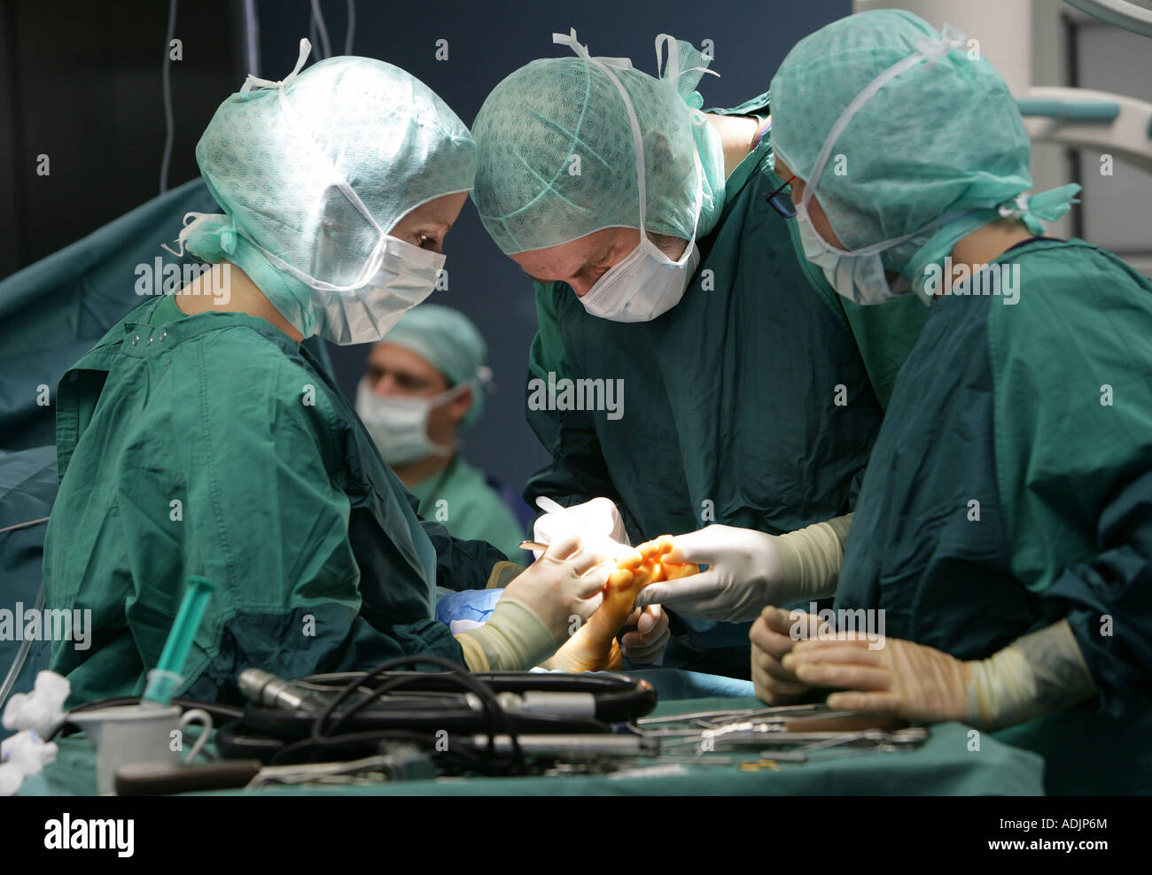 DEU, Germany : Surgery, correction operation of a foot Stock Photo - Alamy