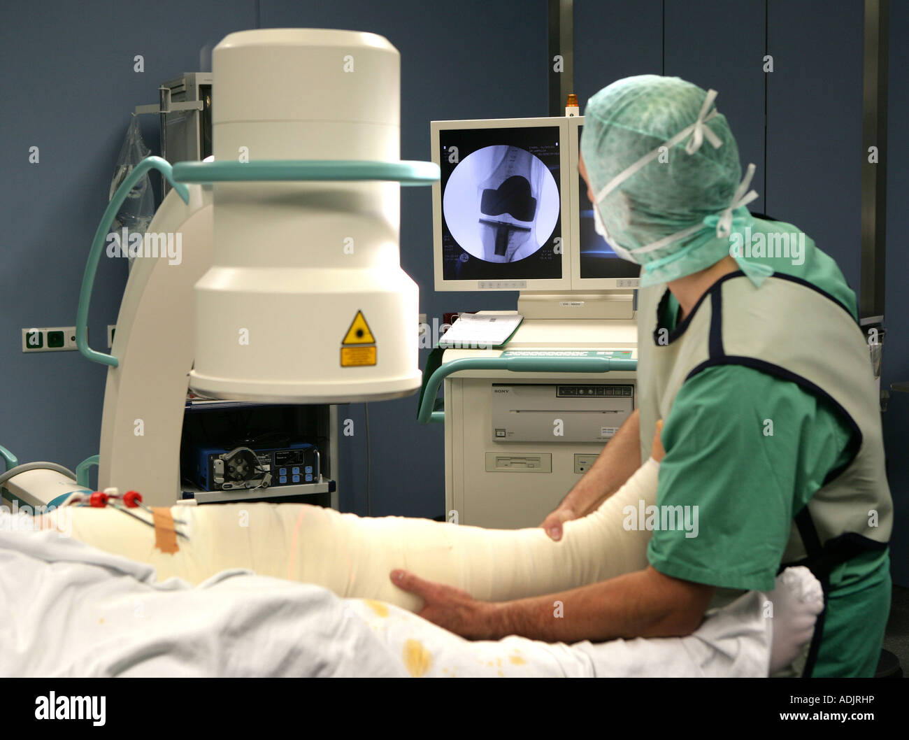 DEU, Germany : Knee surgery, artificial knee joint Stock Photo - Alamy